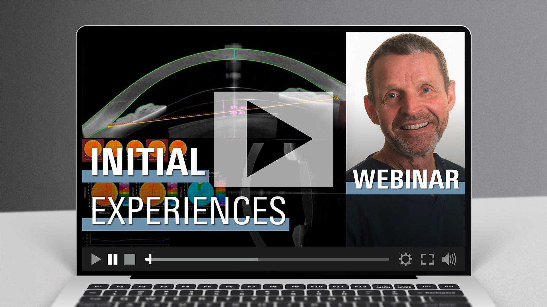 ANTERION – Initial Clinical Experience in a Busy Cataract Clinic ...