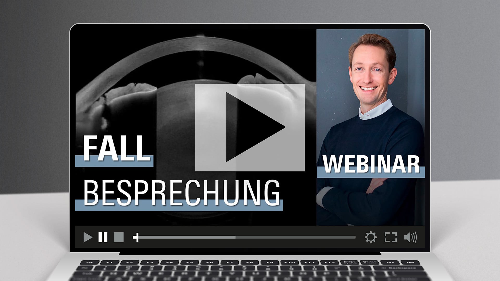 Sprechstunde Vorderabschnitt: Fallbesprechung | Heidelberg Engineering GmbH