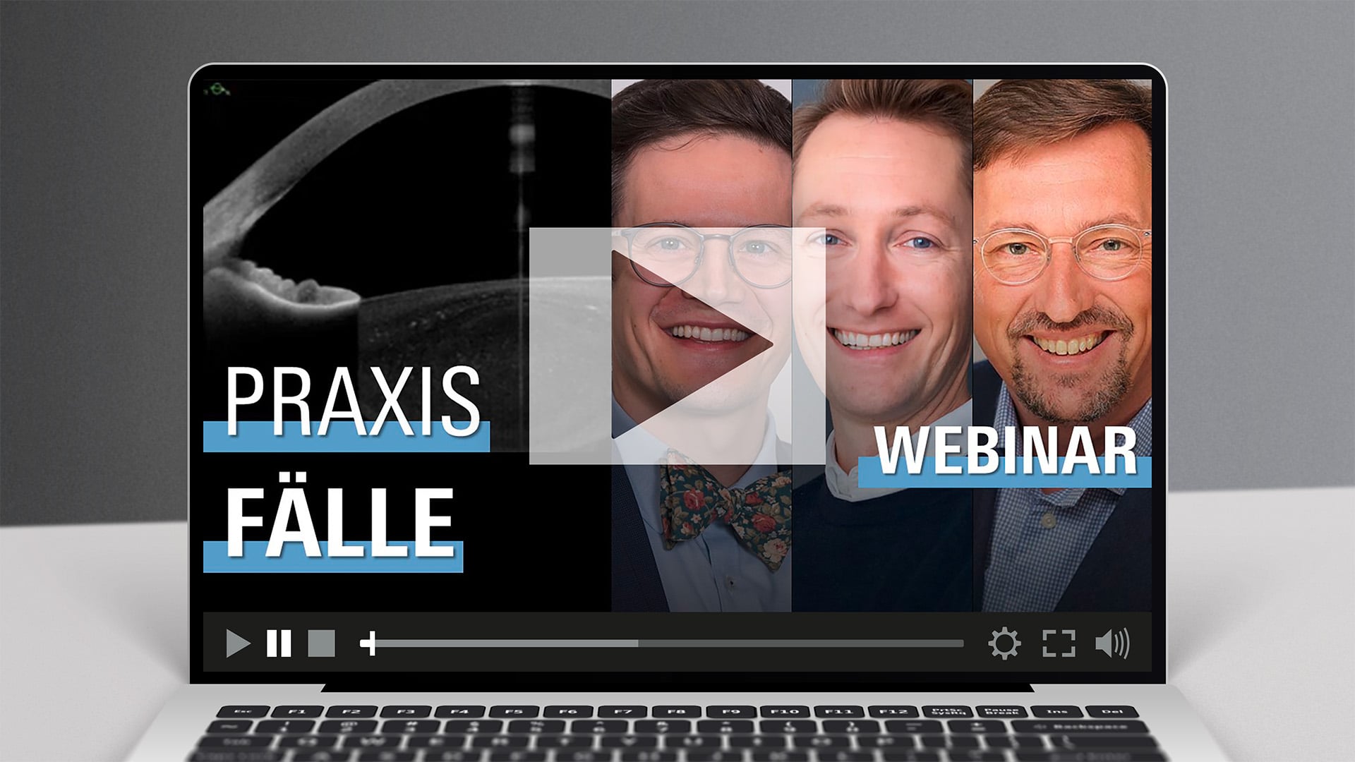Update Vorderabschnitt: Praxisfälle | Heidelberg Engineering GmbH