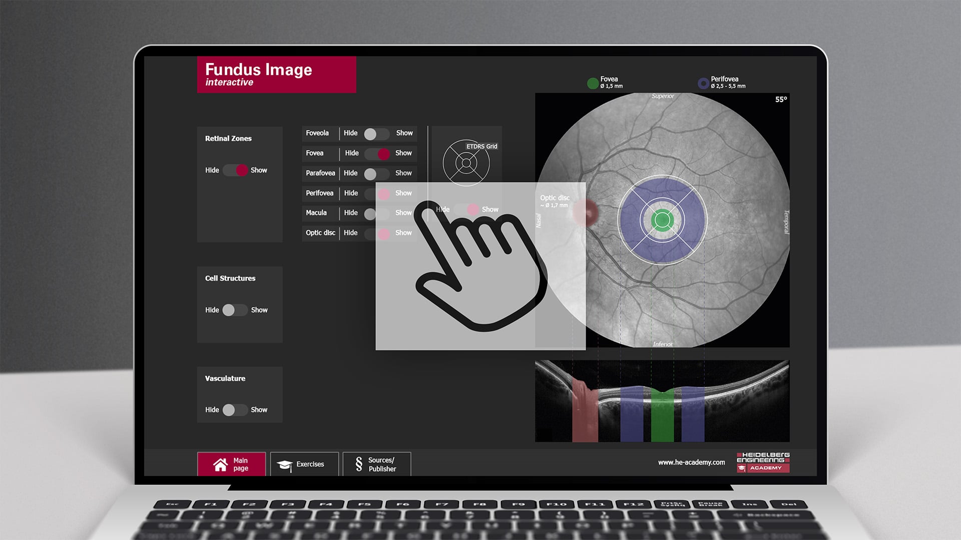 Fundus Image Interactive | Heidelberg Engineering GmbH