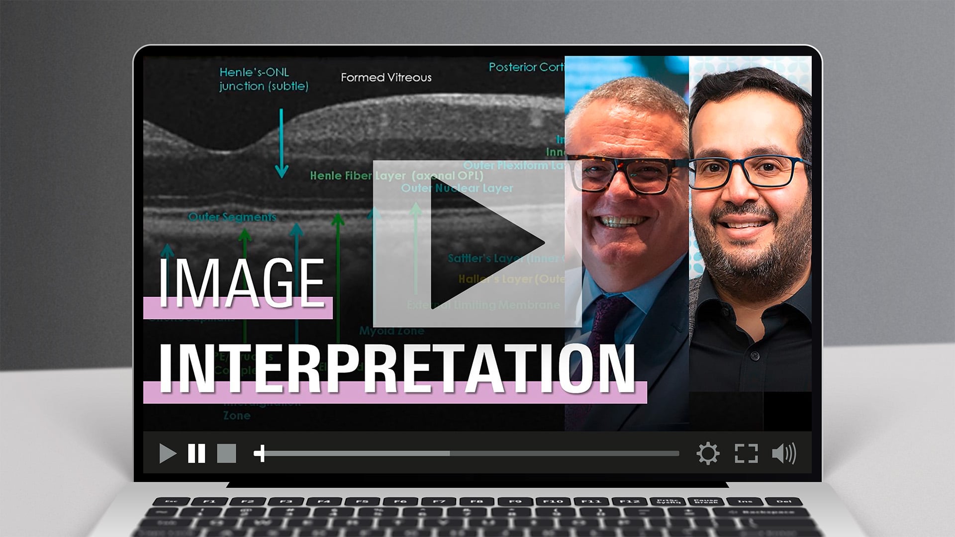 Interpreting the image | Heidelberg Engineering GmbH