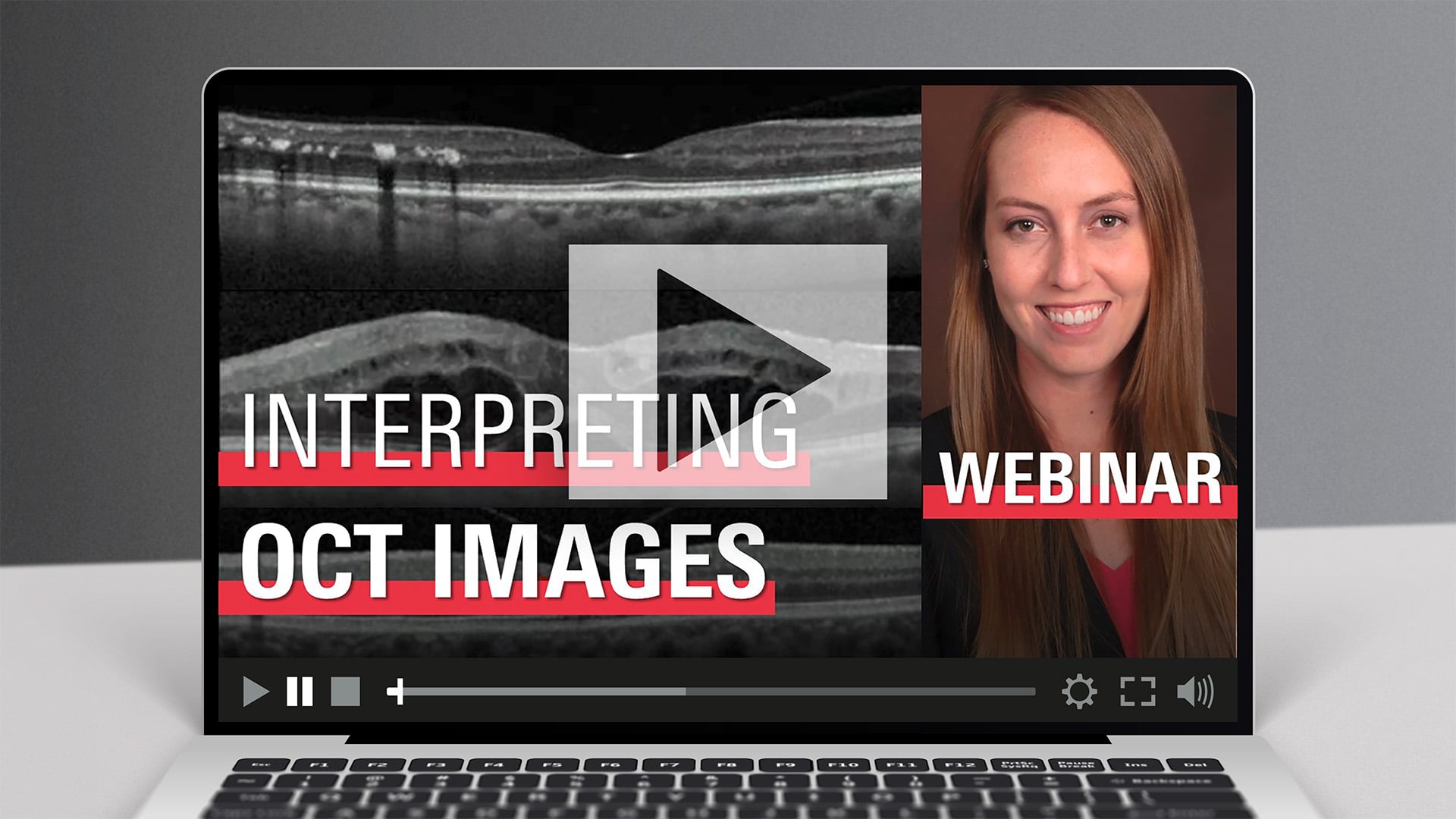 Ordering and Interpreting Retinal OCT Images | Heidelberg Engineering GmbH