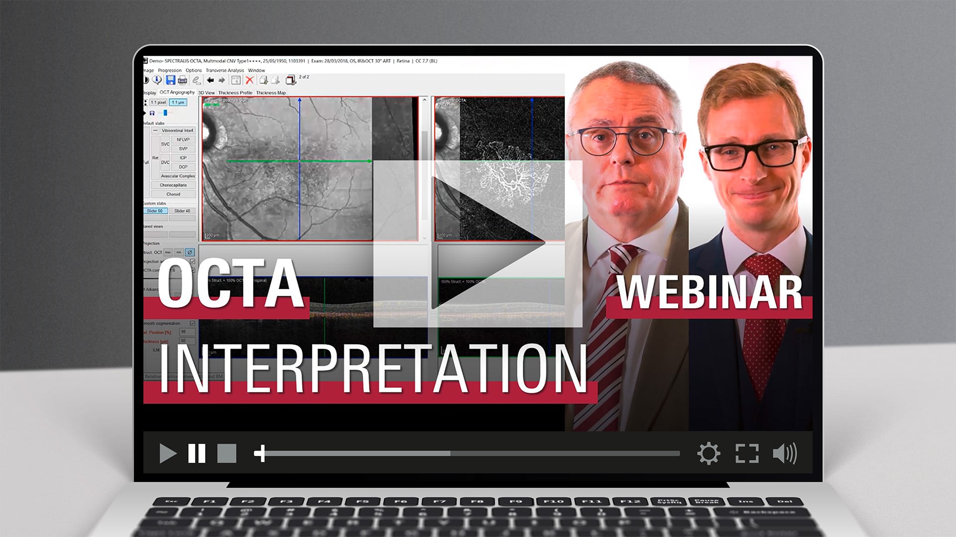 Systematic Interpretation of OCT Angiography Images | Heidelberg ...