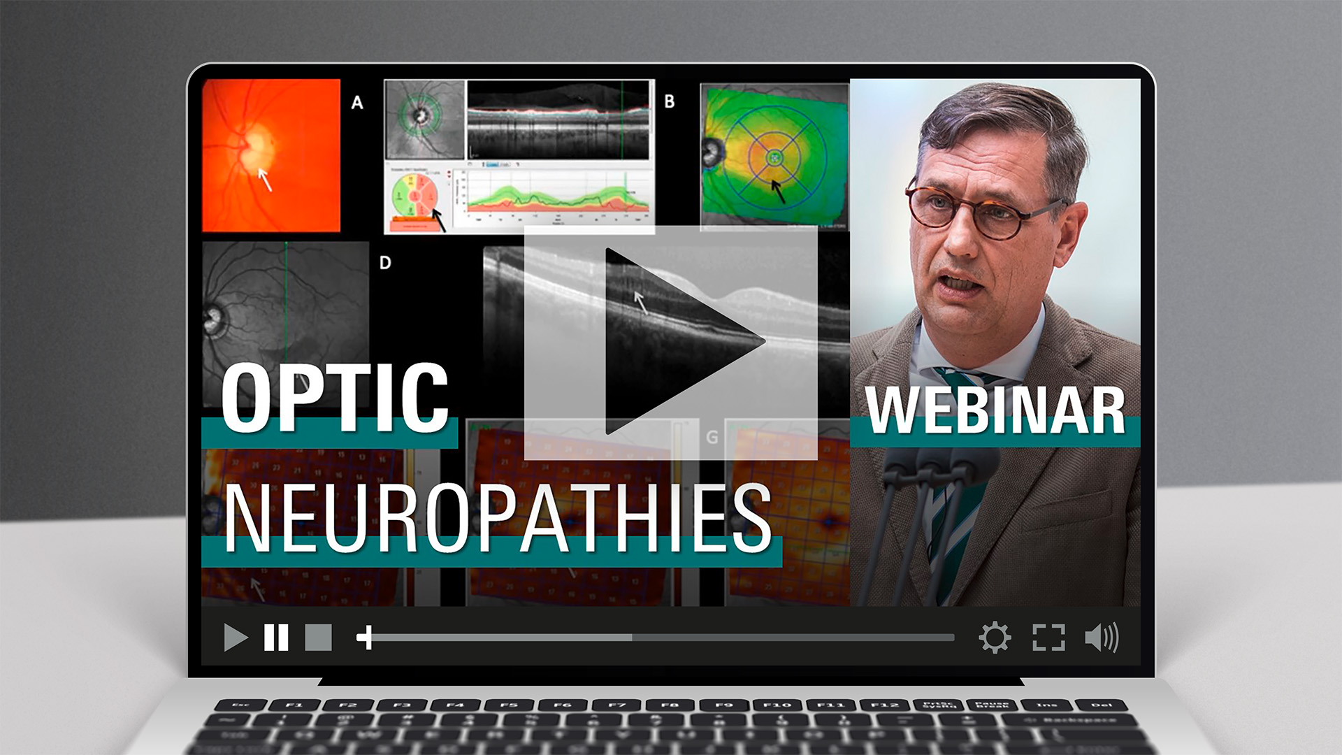 The Glaucoma and Optic Neuropathies Trilogy | Heidelberg Engineering GmbH