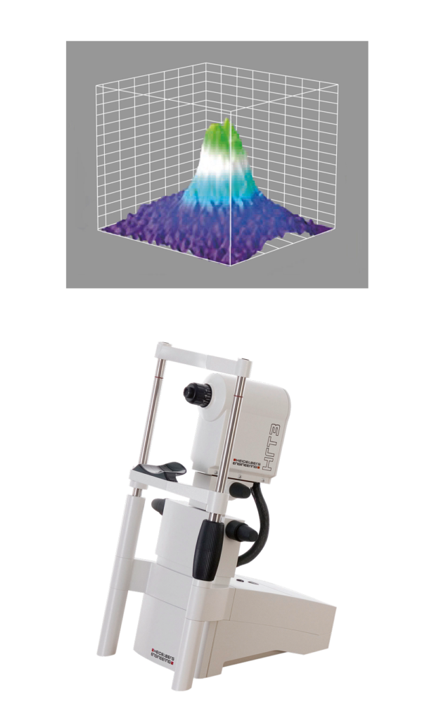 Our History | Heidelberg Engineering GmbH