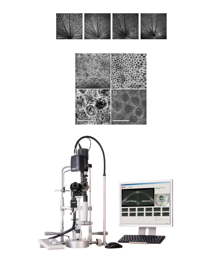 Our History | Heidelberg Engineering GmbH