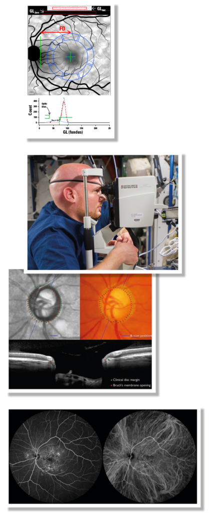 Our History | Heidelberg Engineering GmbH