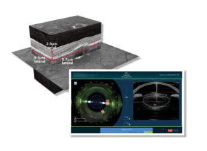 Our History | Heidelberg Engineering GmbH