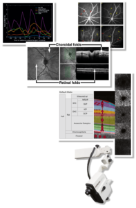 Our History | Heidelberg Engineering GmbH