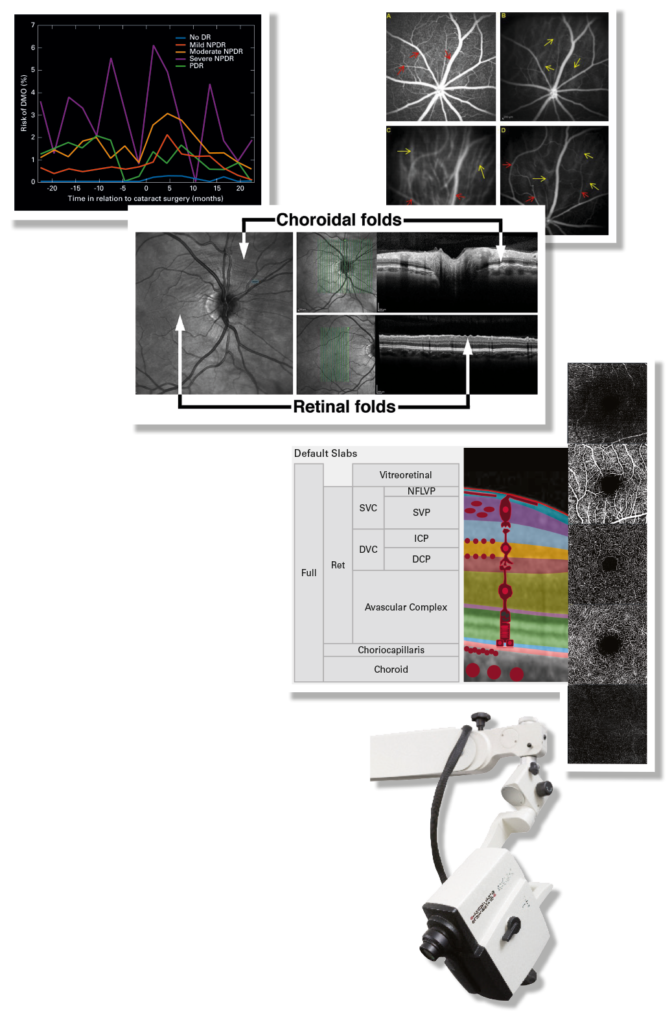 Our History | Heidelberg Engineering GmbH